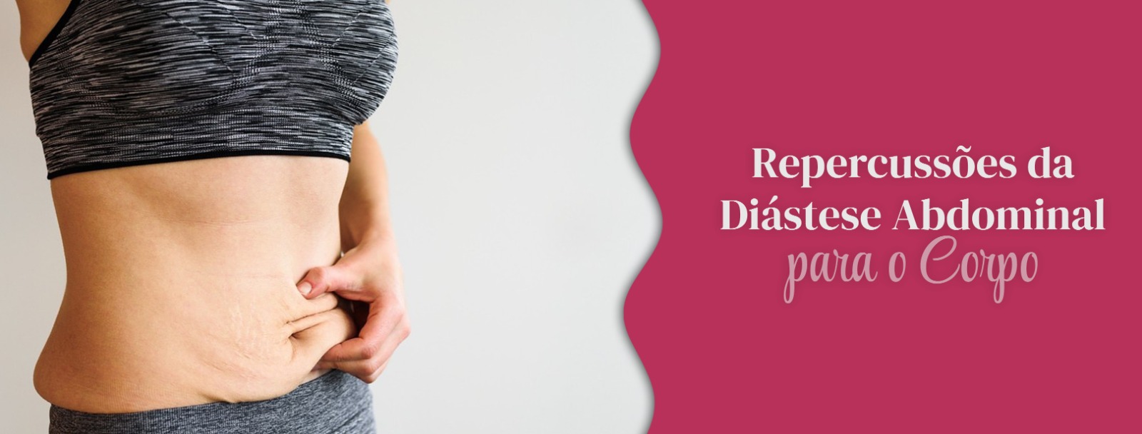 Diástase abdominal: Impacto no corpo e opções de tratamento. - Fisio Mulher